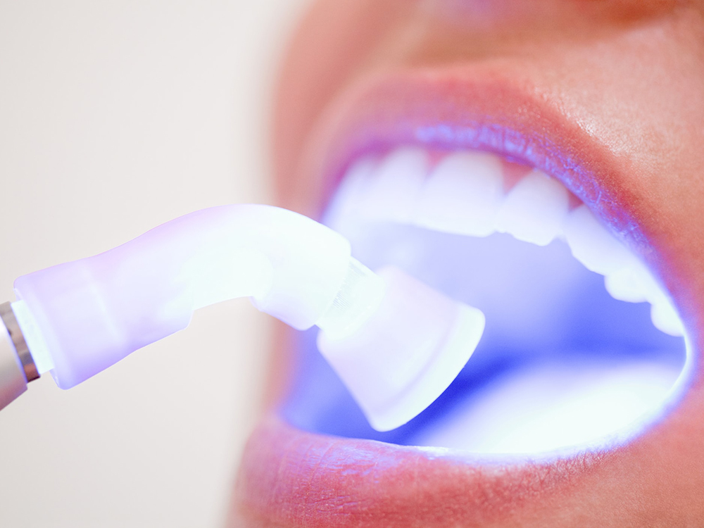 Soft Tissue Laser - Capital Dental - Lincoln, NE